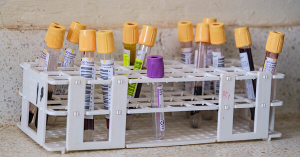 Clinical Trials Day 2026: How GloPID-R drives coordinated, equitable ...